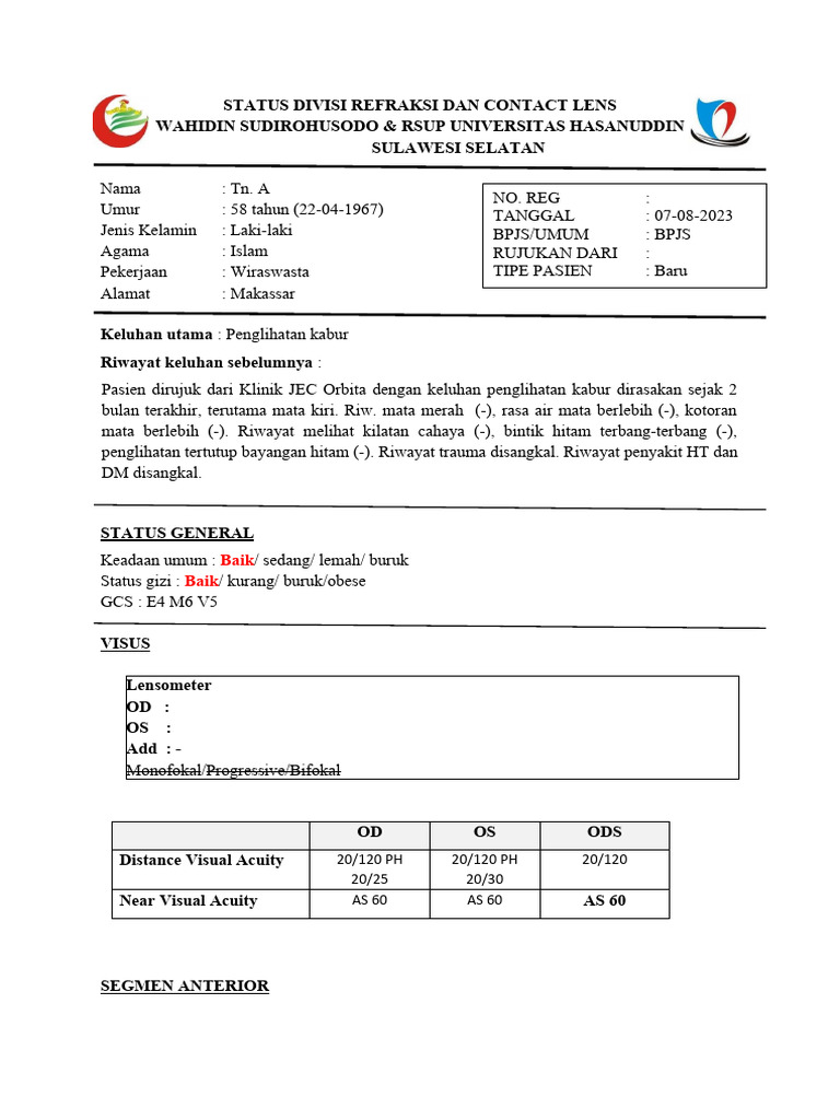 005 NVI - OS Compound Hipermeteropia Astigmatism + Presbyopia | PDF