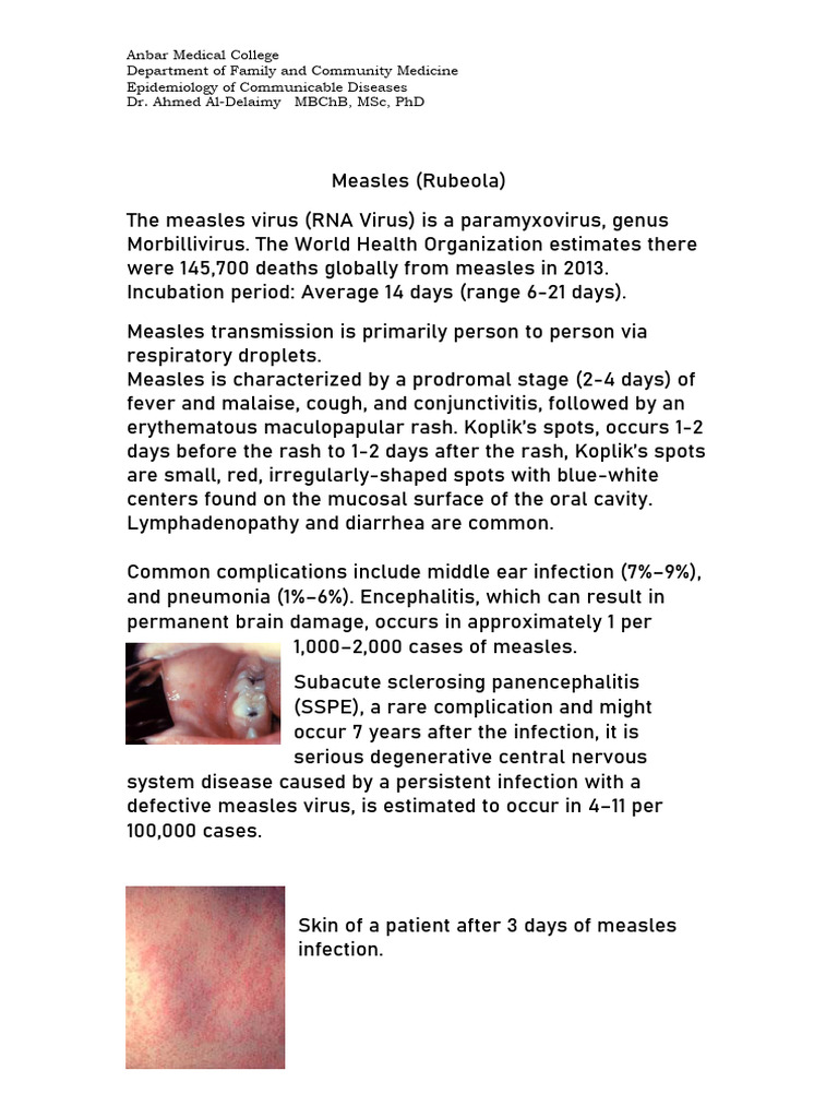 Measles | PDF | Measles | Vaccines