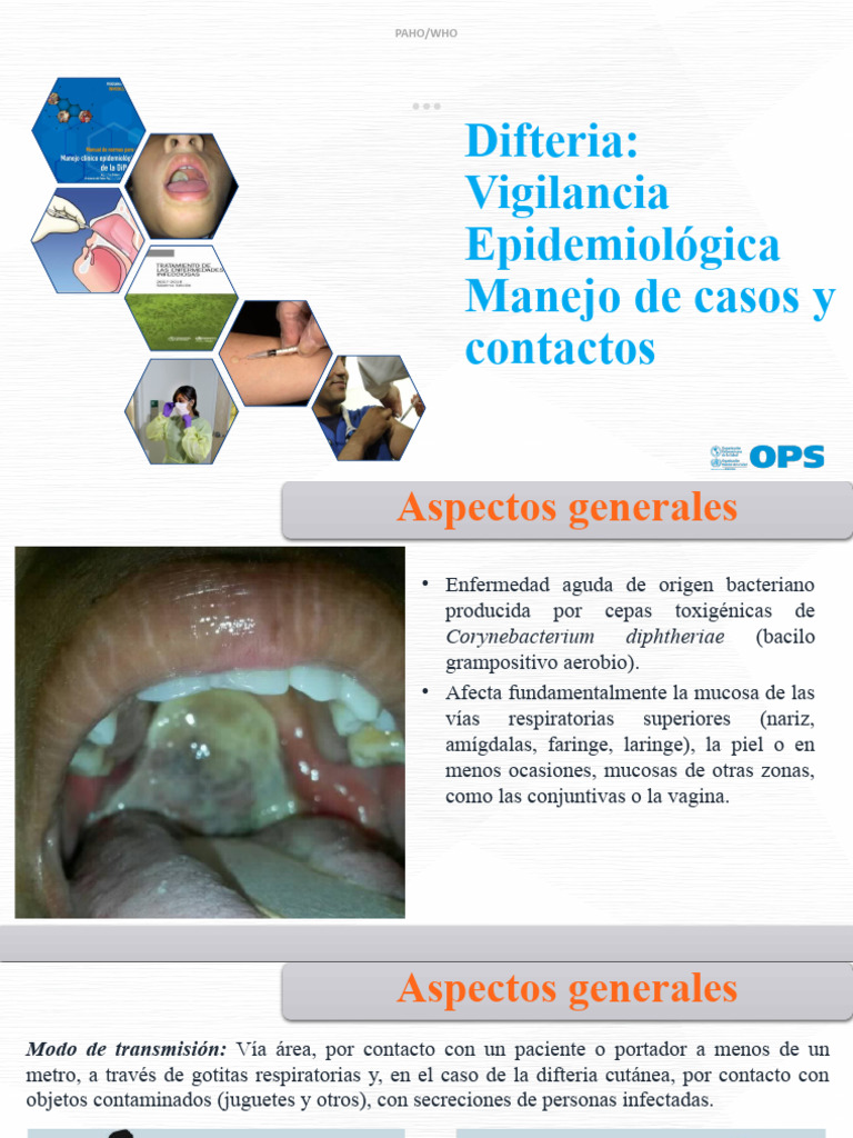 Vigilancia Epidemiológica y Manejo de DIFTERIA | PDF | Especialidades Medicas | Medicina