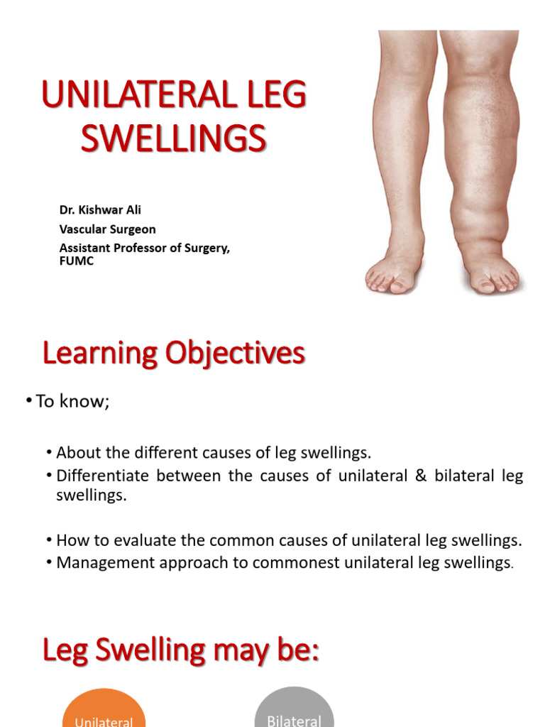 Unilateral Leg Swellings Guide | PDF | Vein | Edema