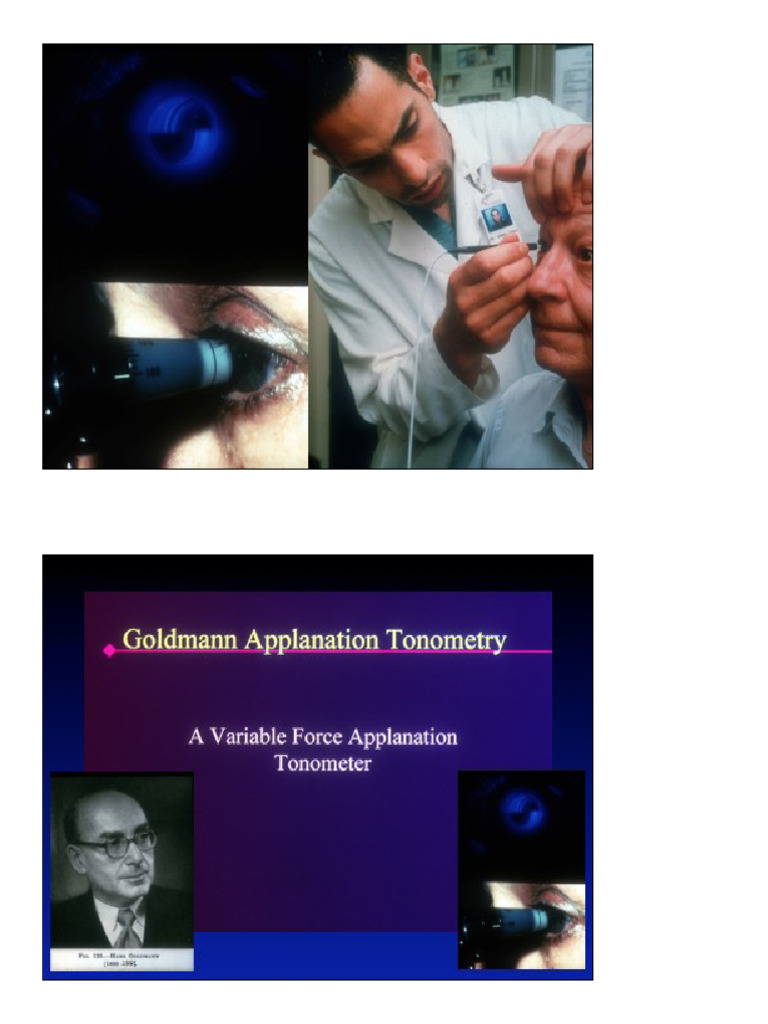 Tonometry 3183 3183 | PDF