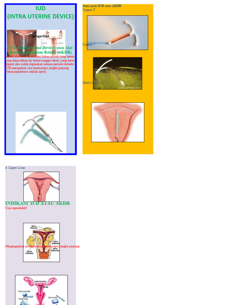Leaflet IUD | PDF