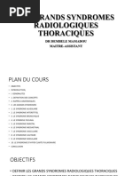 Syndrome cave supérieur : symptômes et causes | PDF