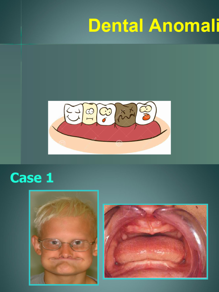 5.dental Anomalies PDF | PDF | Tooth Enamel | Dental Anatomy
