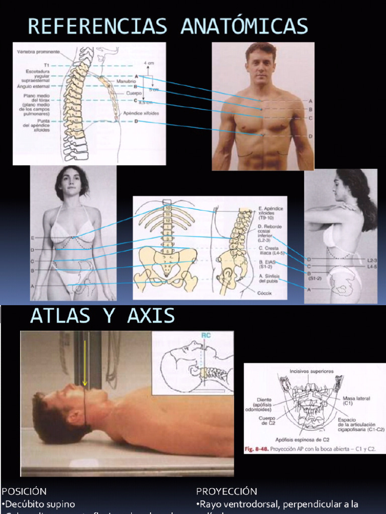 Columna Vertebral RX | PDF