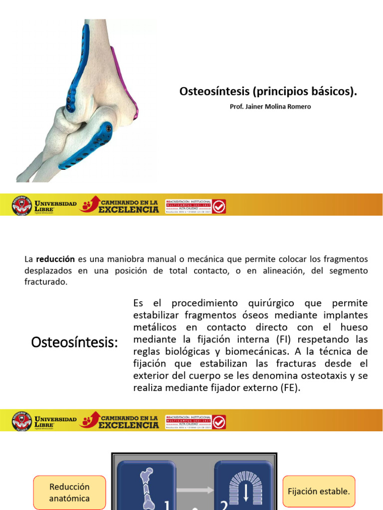 Principios de Osteosíntesis y Fijación Ósea | PDF | Tornillo | Hueso