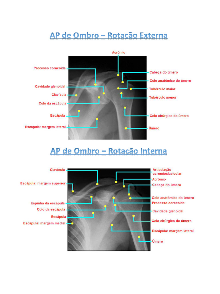 Anatomia Radiológica - Ombro | PDF