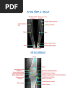 Anatomia Tibia e Fibula | PDF