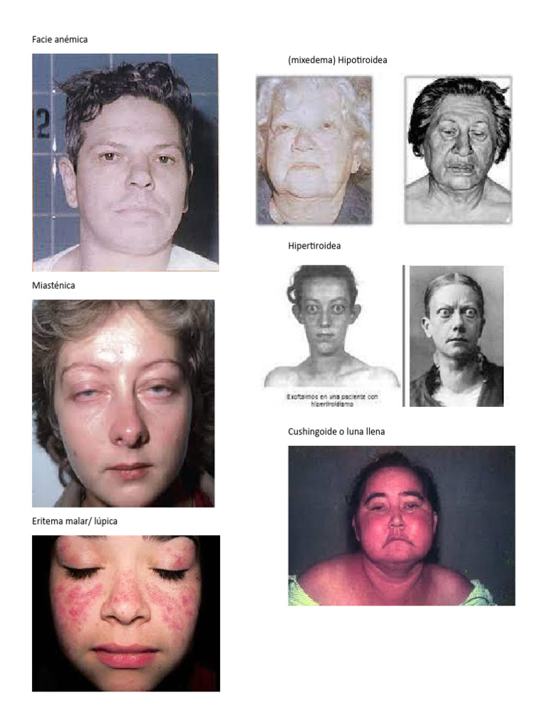 Clasificación de Facies Clínicas | PDF