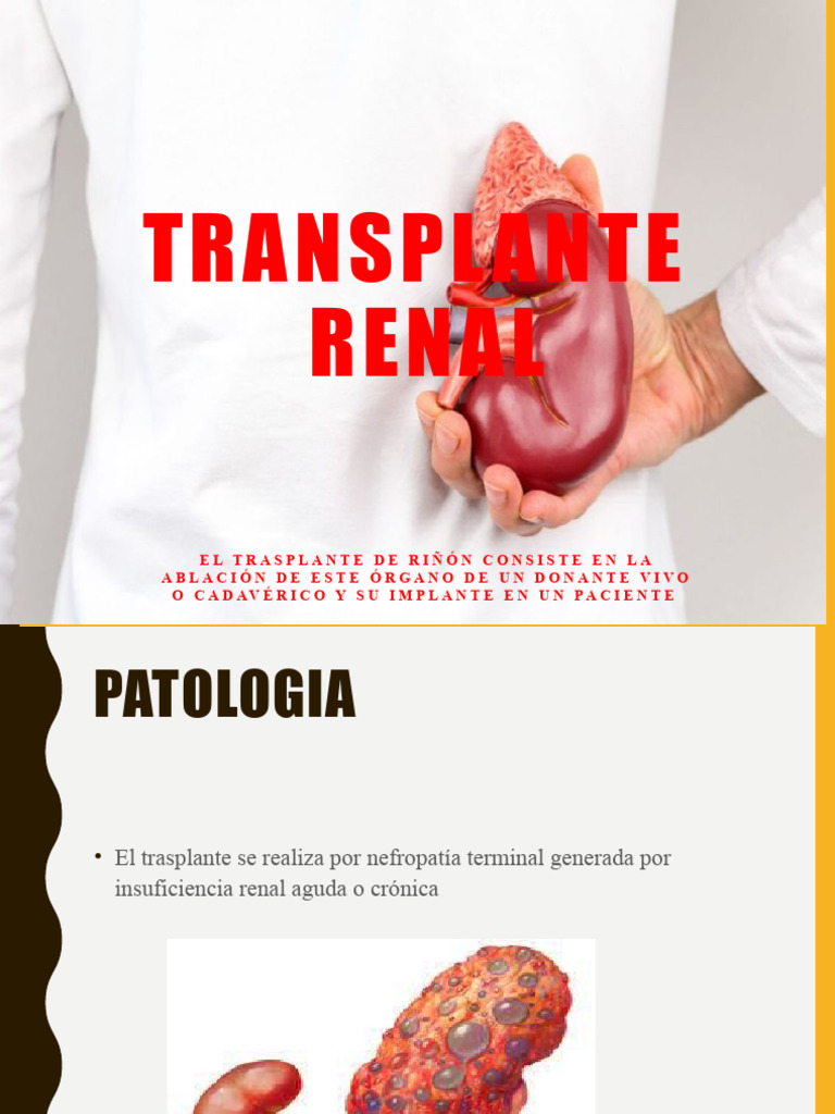 Transplante Renal Presentacion | PDF | Trasplante de riñón | Artería