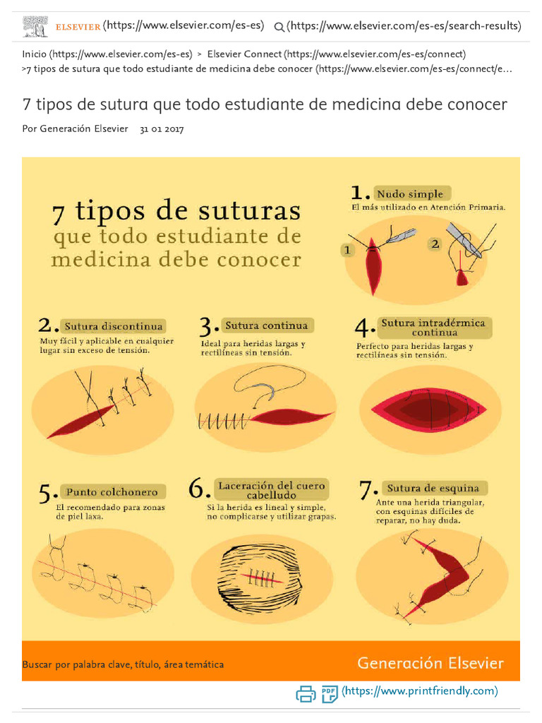 7 Tipos de Sutura Que Todo Estudiante de Medicina Debe Conocer | Descargar gratis PDF | Medicina ...
