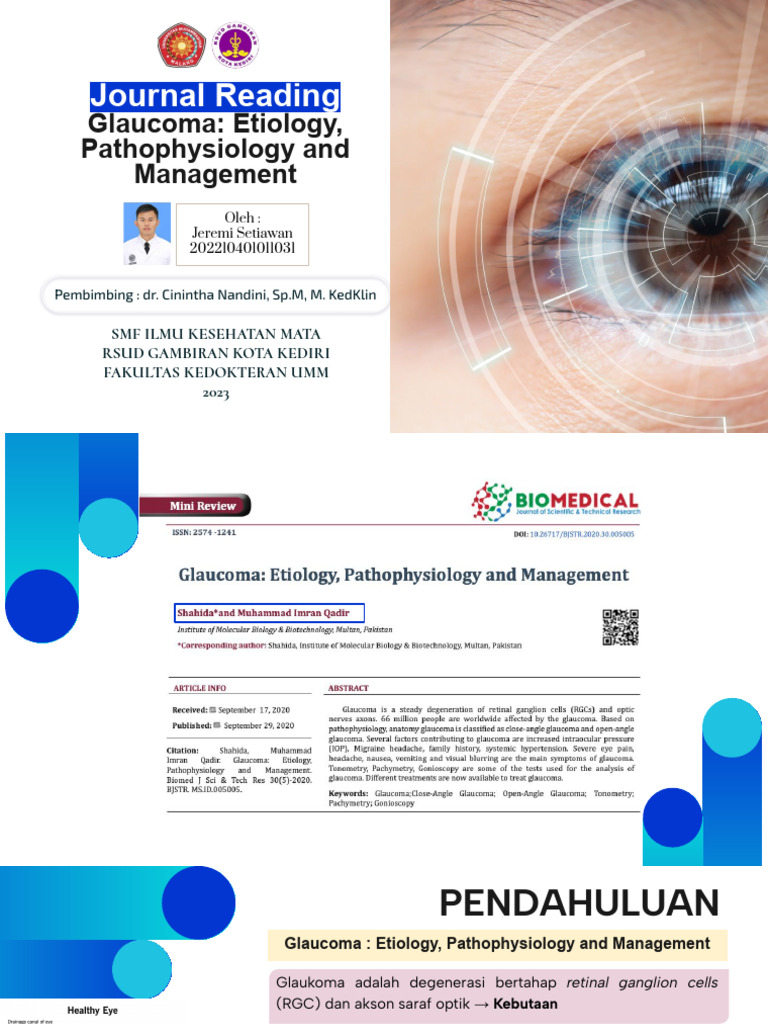 JR MATA Glaucoma | PDF