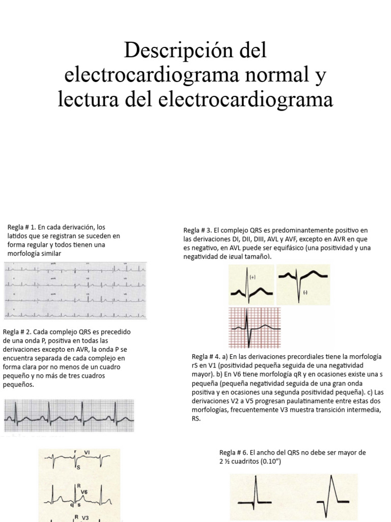 Descripción del electrocardiograma normal y lectura del ...