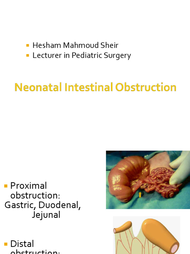 03 - Neonatal Intestinal Obstruction | PDF | Sepsis | Digestive Diseases