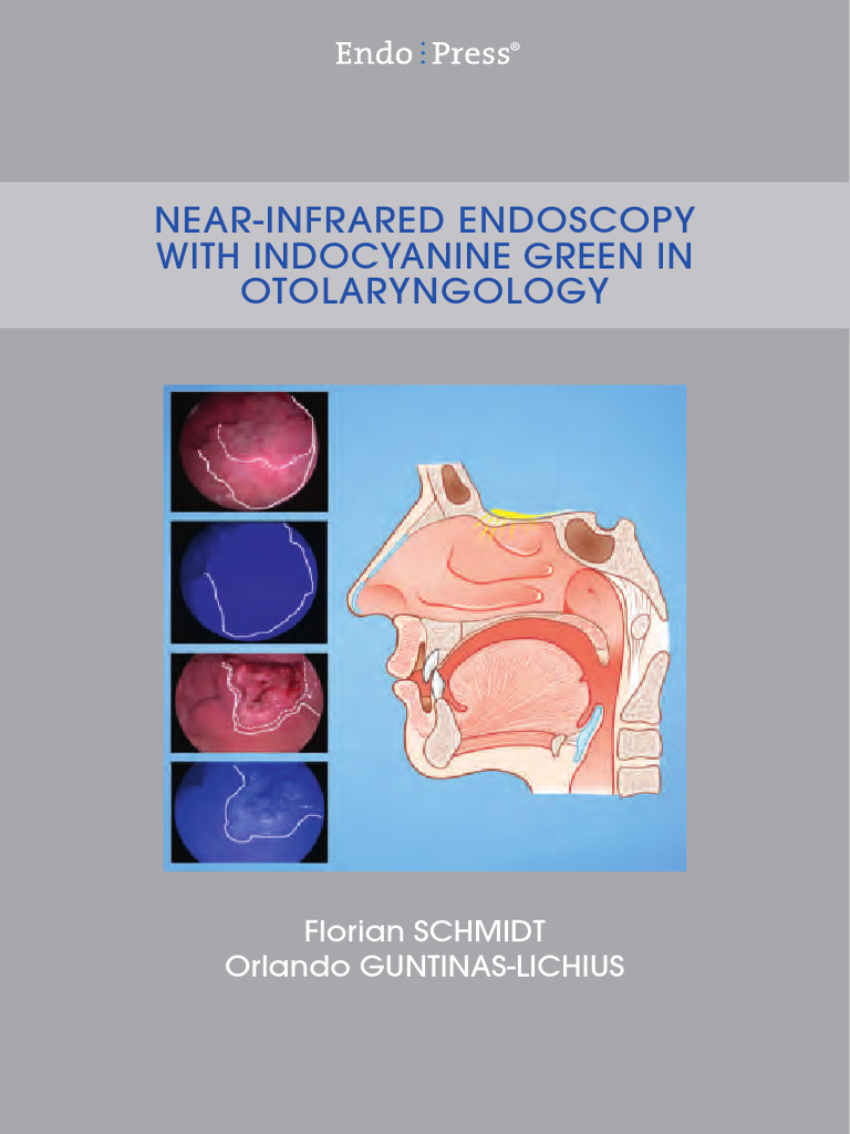 Near-INfrared Endoscopy With INdocyaNINe GreeN IN otolaryNGoloGy | PDF ...