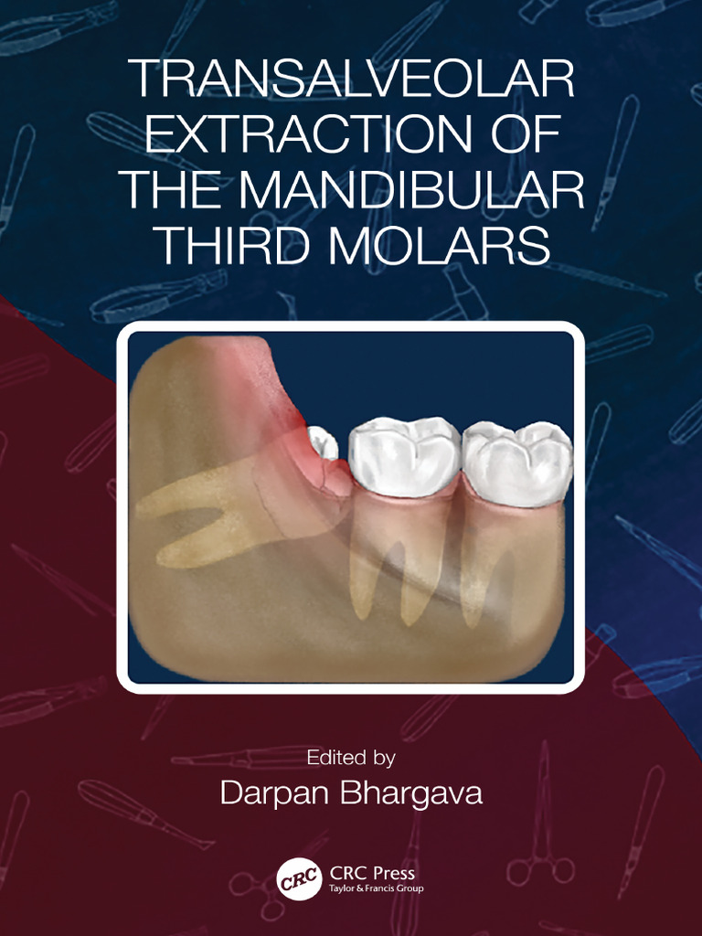 Transalveolar Extraction of The Mandibular Third Molars | Download Free ...