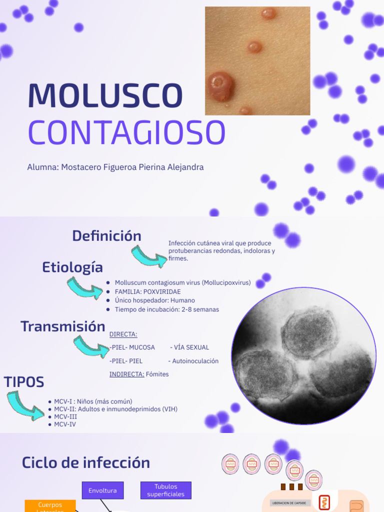 Molusco Contagioso | PDF | Especialidades Medicas | Medicina CLINICA