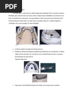 Principios PPR Apoyos, Retenedor Directo e Indirecto | PDF | Dentadura ...