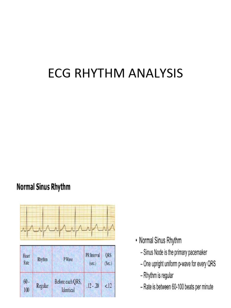 Estiamtion of R-R Interval | PDF | Signal Processing | Computer Engineering
