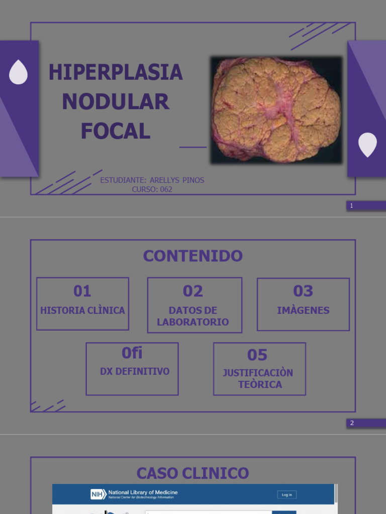 Hiperplasia Nodular Focal | PDF | Cuidado de la salud | Hormona