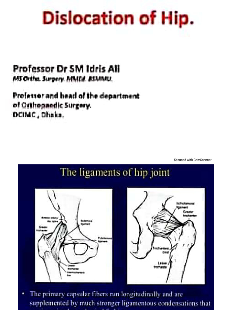 Hip Dislocation | PDF