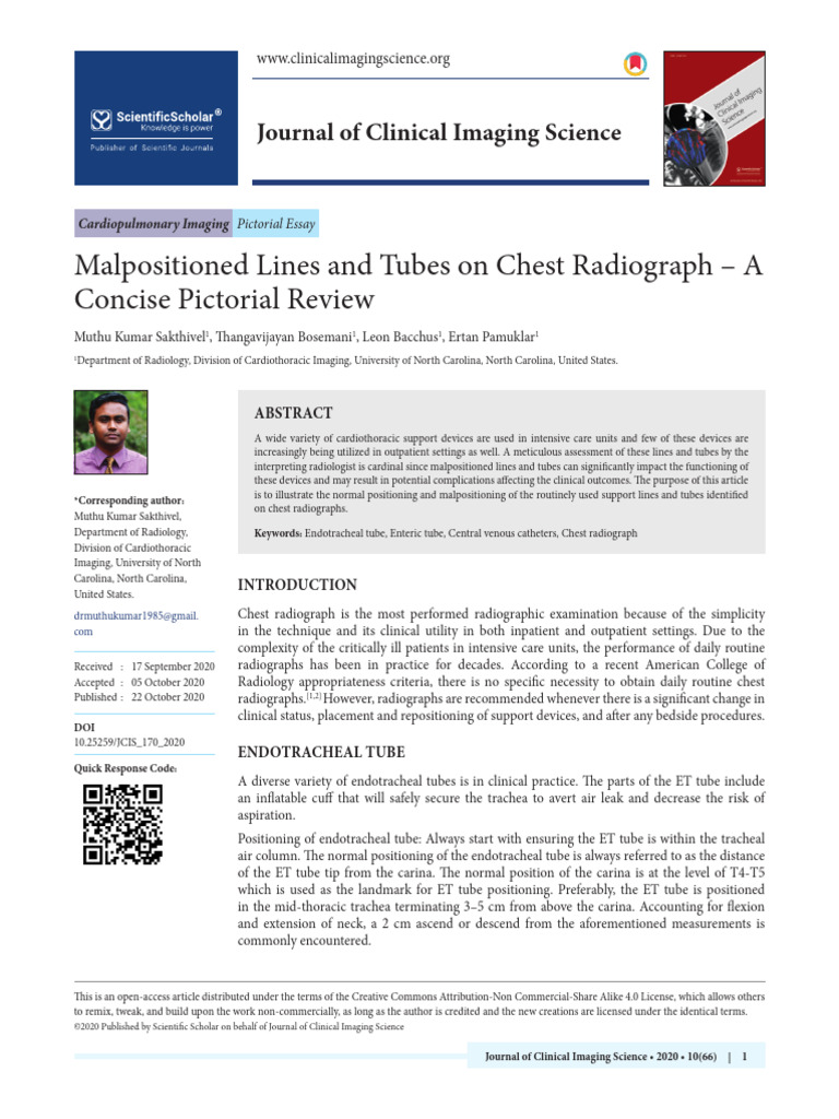 Malpositioned Lines and Tubes On Chest Radiograph Â A Concise Pictorial ...
