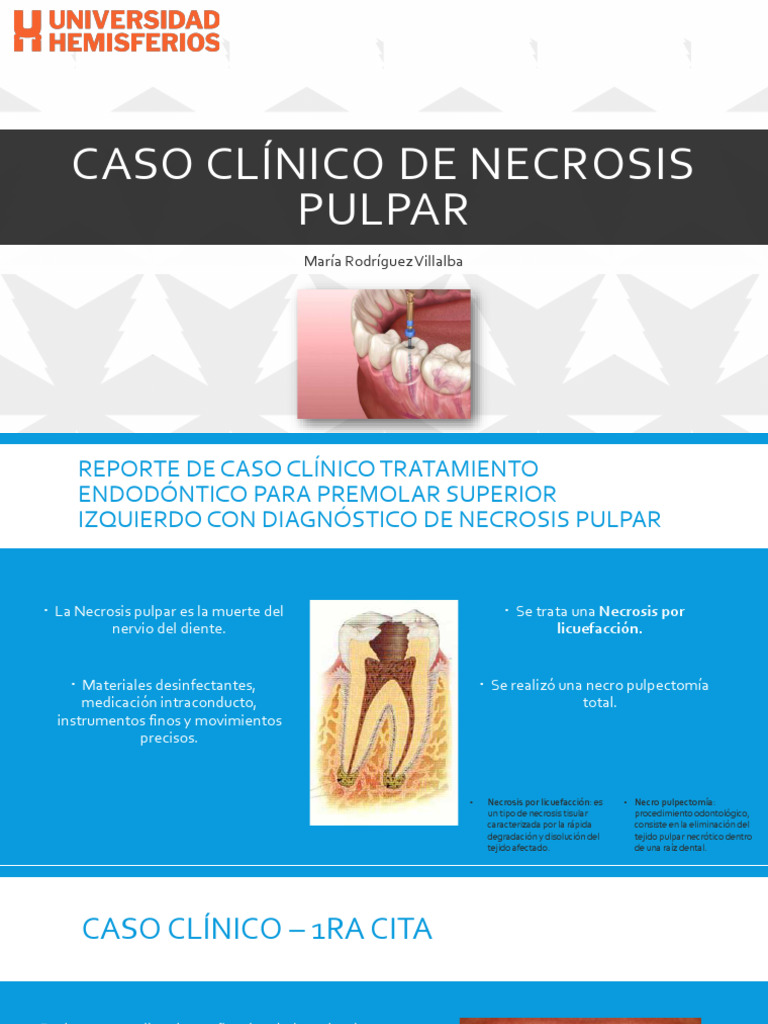 Caso Clínico Necrosis Pulpar. - MRodriguez | PDF | Cuidado de la salud ...