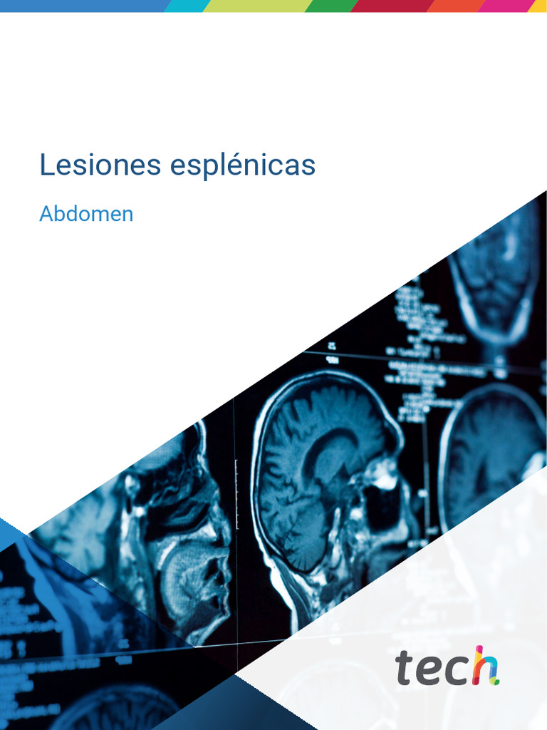 9.lesiones Esplenicas | PDF | Bazo | Metástasis