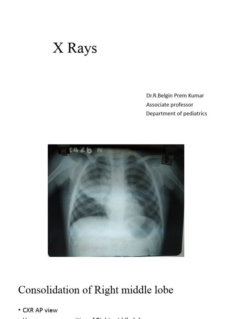X Rays | PDF
