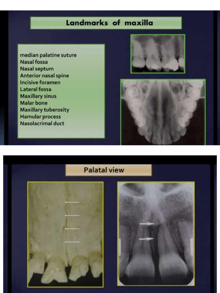Anatomical Landmarks in Radiographs | PDF