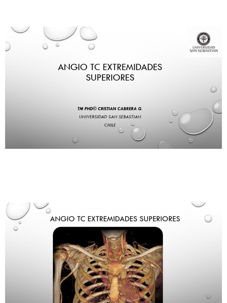 Angio TC Ex Sup | PDF | Isquemia | Trombo