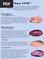 Onfalitis Neonatal Informe | PDF | Septicemia | Inflamación