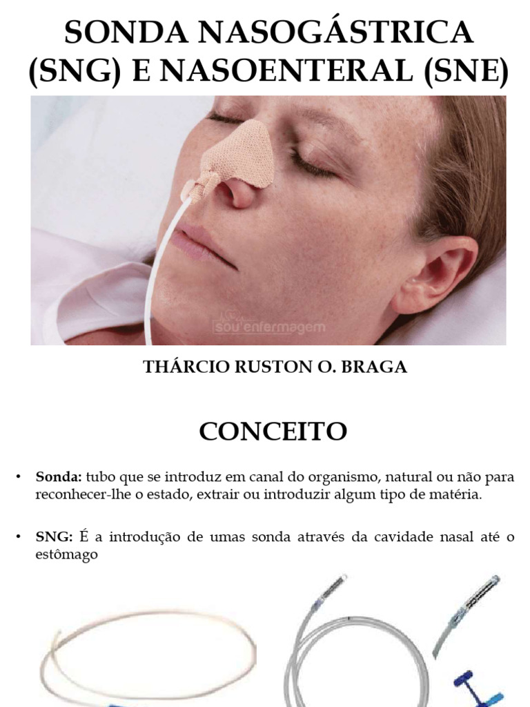 SONDA NASOGÁSTRICA E NASOENTERAL (1) | PDF | Enfermagem | Medicina Clínica