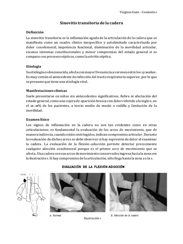 Sinovitis Transitoria de La Cadera | Descargar gratis PDF | Medicina ...