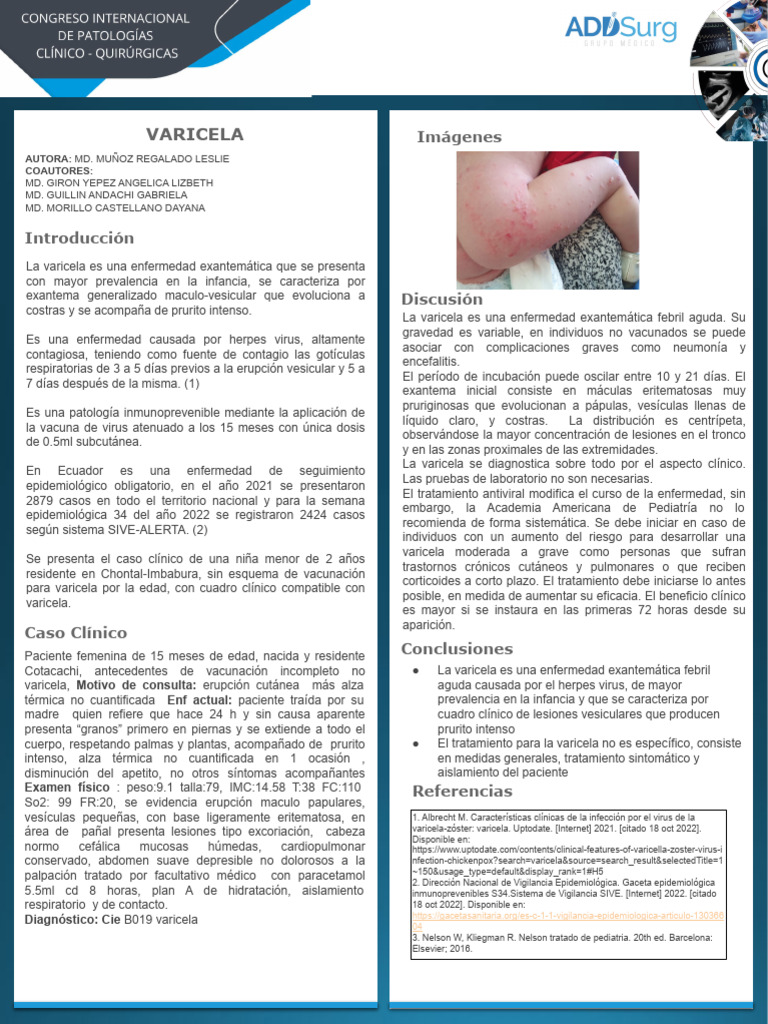 Poster Varicela | PDF | Inmunología | Salud pública