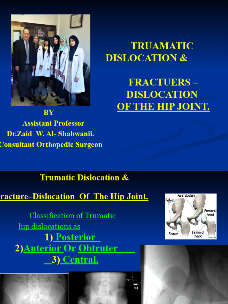 Hip Joint Dislocation | PDF | Hip | Human Anatomy