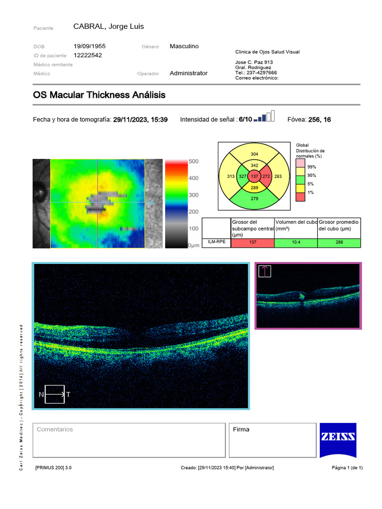 Hc8866-Oct Macular Ao-20231129-154053-0004 | PDF