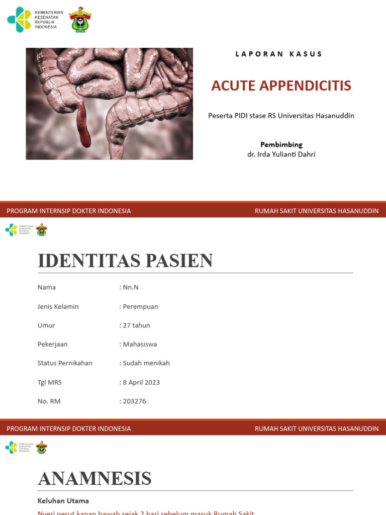 Acute Appendicitis | PDF