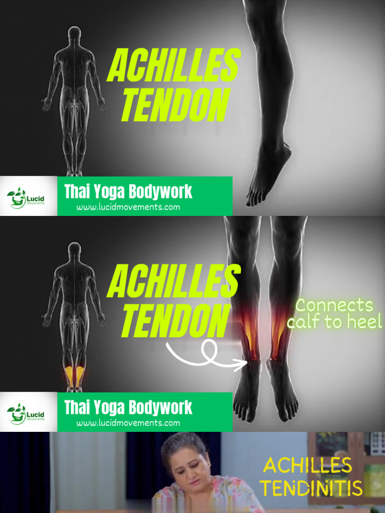 Achilles Tendon | PDF