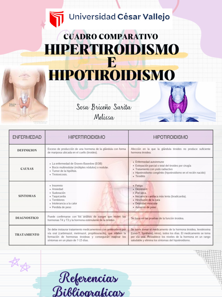 Comparativa Hipertiroidismo vs Hipotiroidismo | PDF | Hipertiroidismo | Tiroides