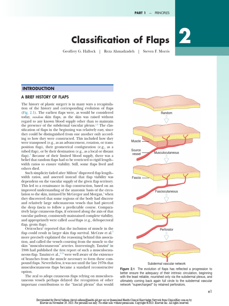 Classification of Flaps | PDF | Human Anatomy | Morphology (Biology)