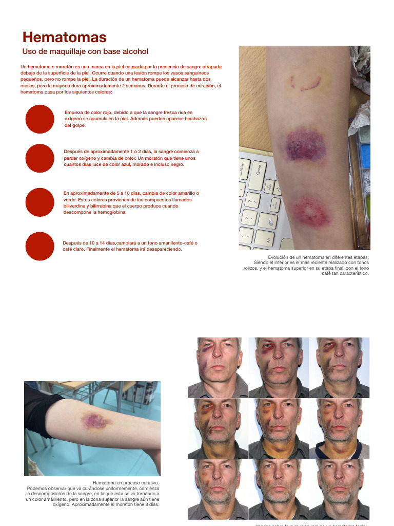 Hematomas - Dave González | PDF | Sangre | Color