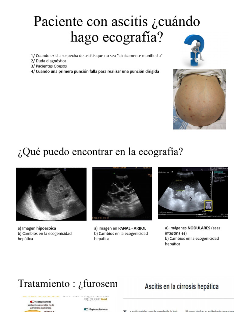 Paciente Con Ascitis ¿Cuándo Hago Ecografía | PDF