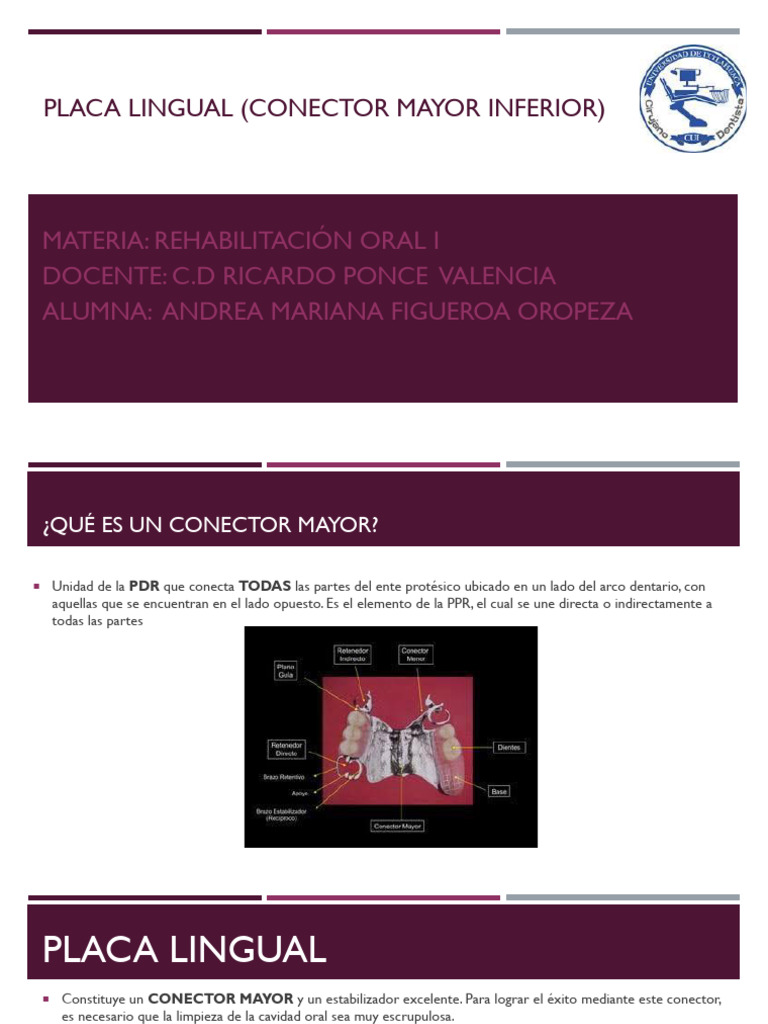 Placa Lingual y Conector Mayor Inferior | PDF