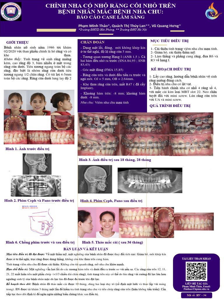 Case Report Orthodontics in Periodontics Patient | PDF