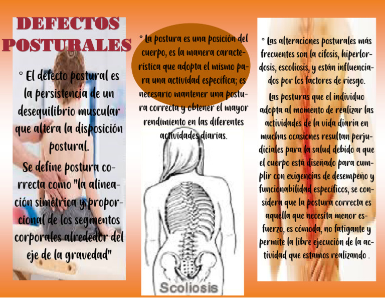 Tríptico Defectos Posturales | PDF