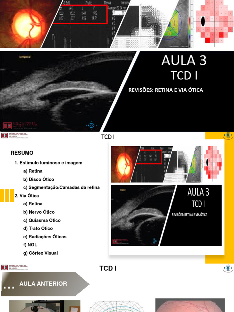 TCD1 - AULA - 3 - Revisões Retina e Via Otica | PDF | Sistema visual | Neurociência