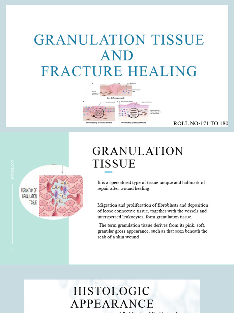 Granulation Tissue and Fracture Healing. (Final) | PDF | Wound Healing ...