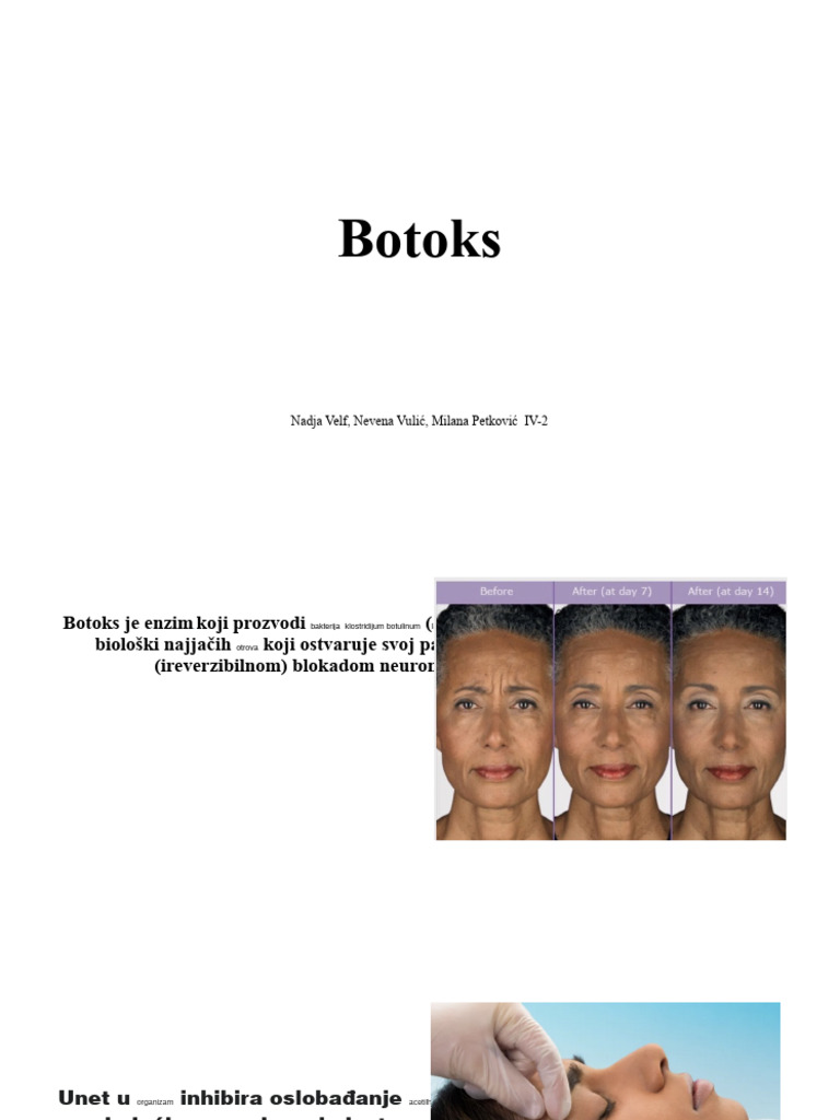 Prezentacija 2 | PDF