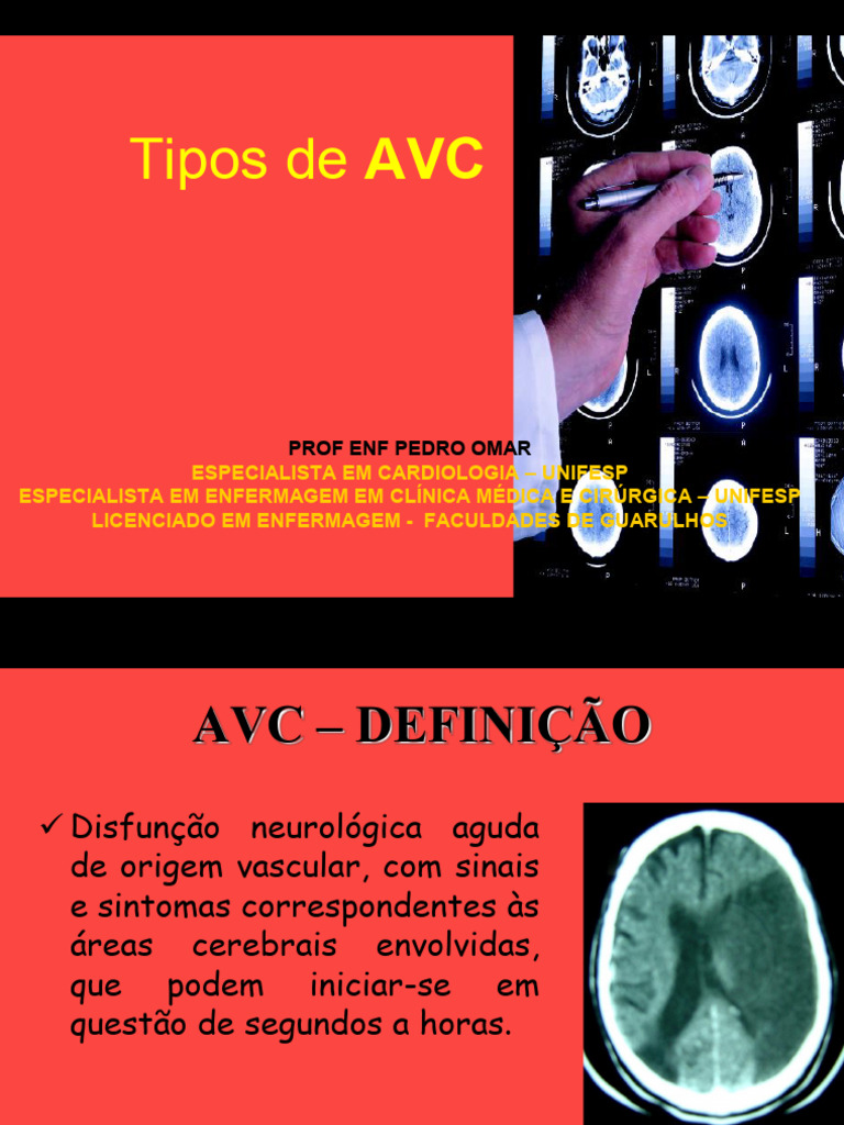 Aula 1 - Tipos de AVC | PDF | AVC | Doenças e distúrbios